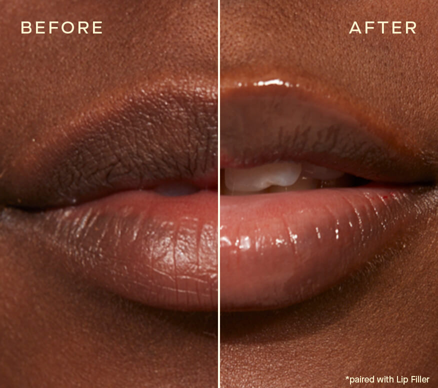 Too Faced Lip Injection Before After