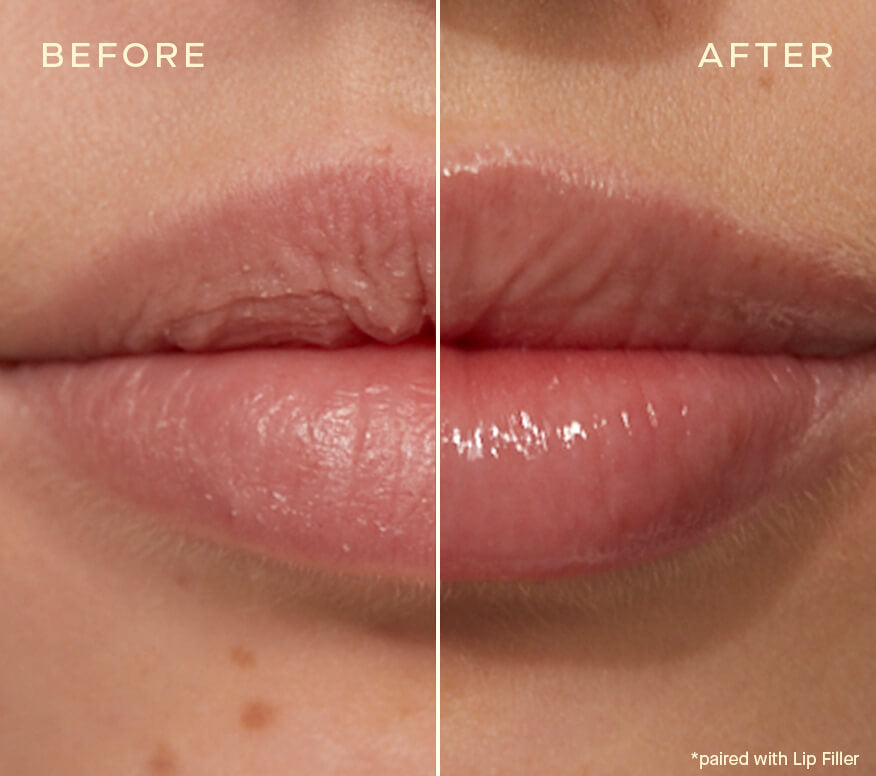 The Lip Plumping & Enhancing Regimen: Fill & Smooth – Ourself